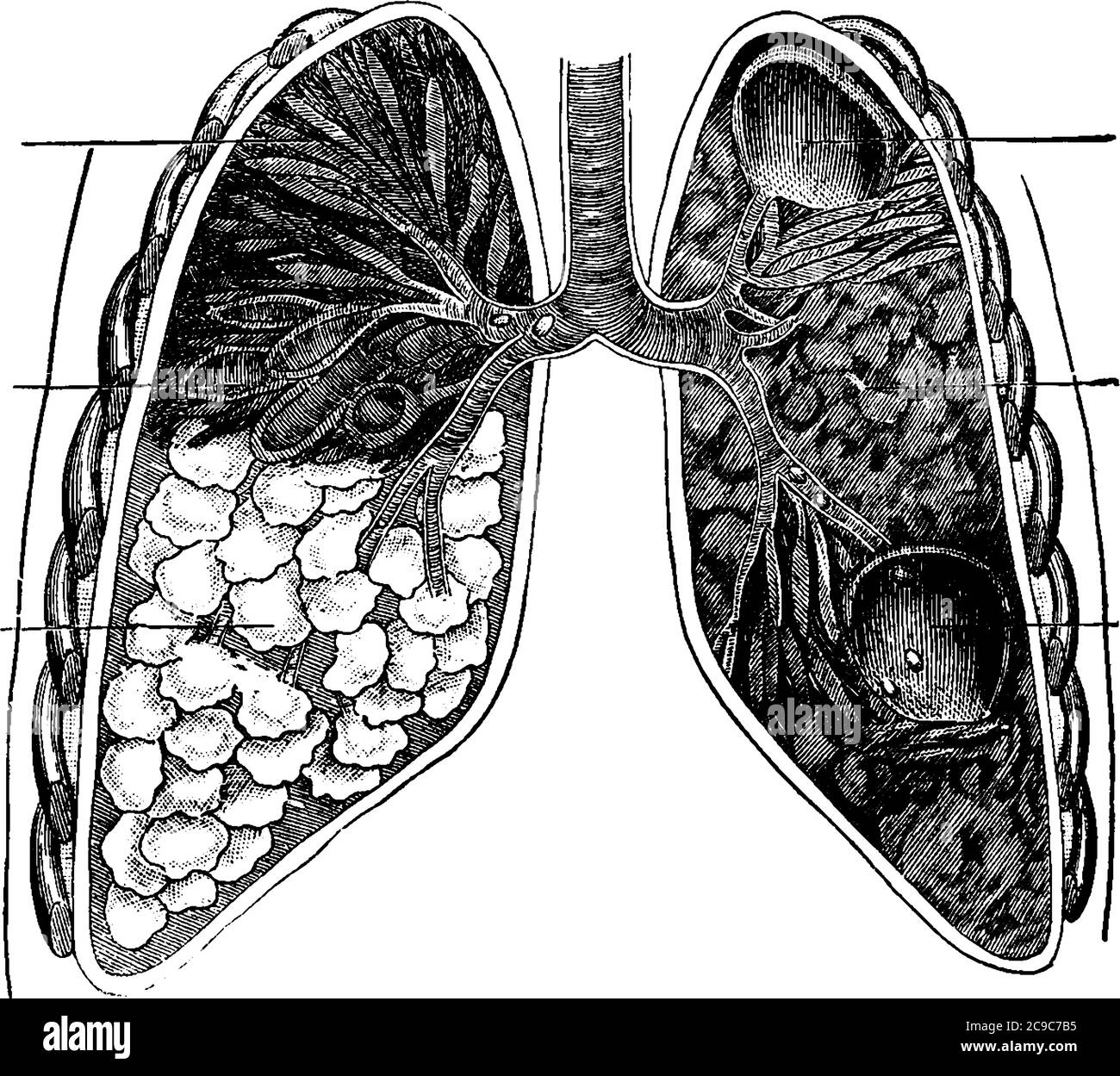 Funktion Der Lunge Stockfotos und -bilder Kaufen - Alamy