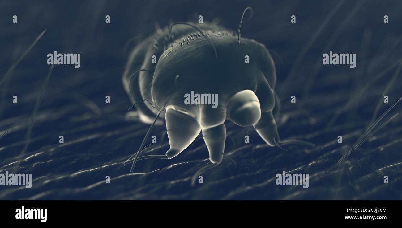 Krätze milbe auf der menschlichen haut -Fotos und -Bildmaterial in ...