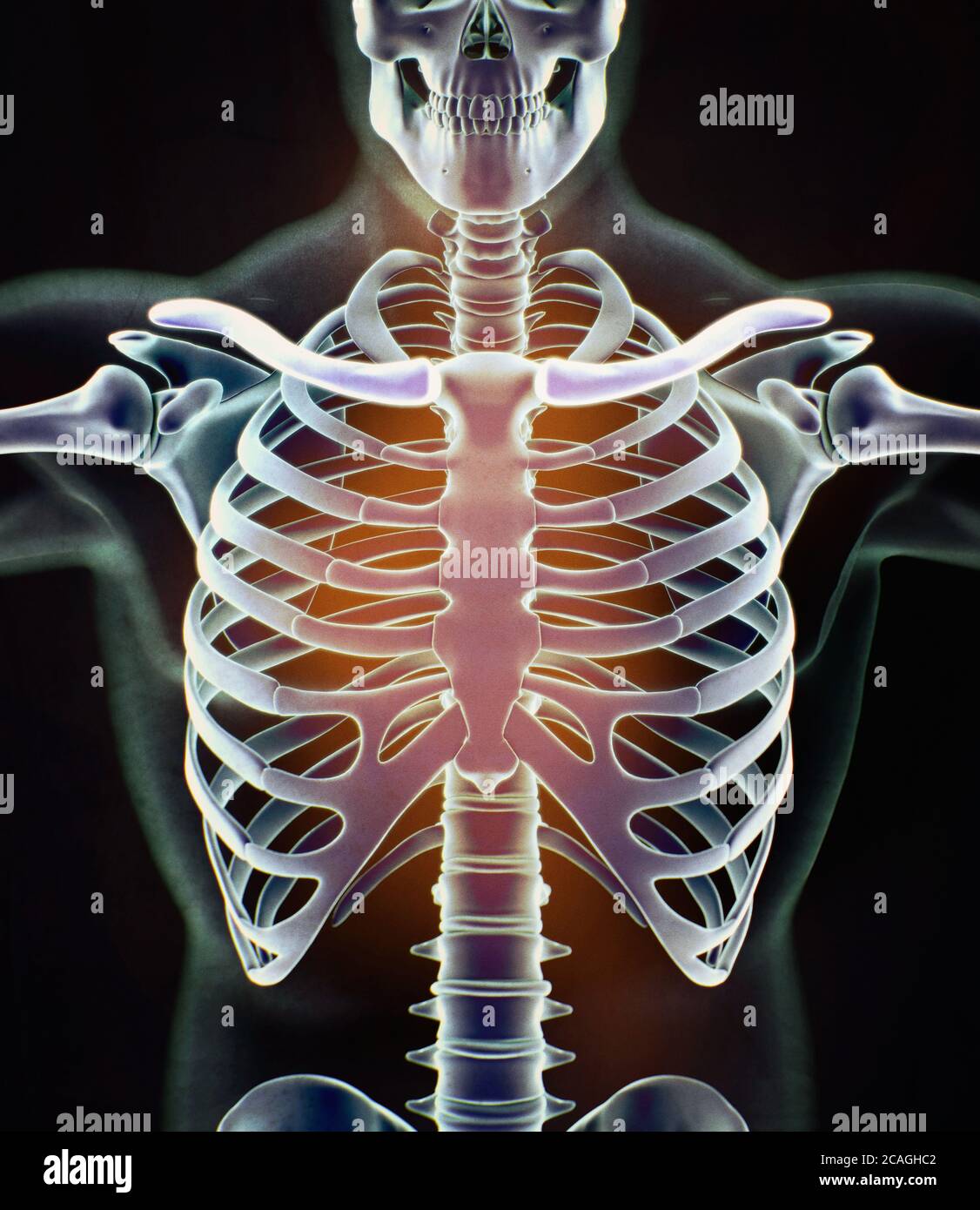 Halsband Knochen Röntgen. Menschliche Anatomie Skelettsystem ...