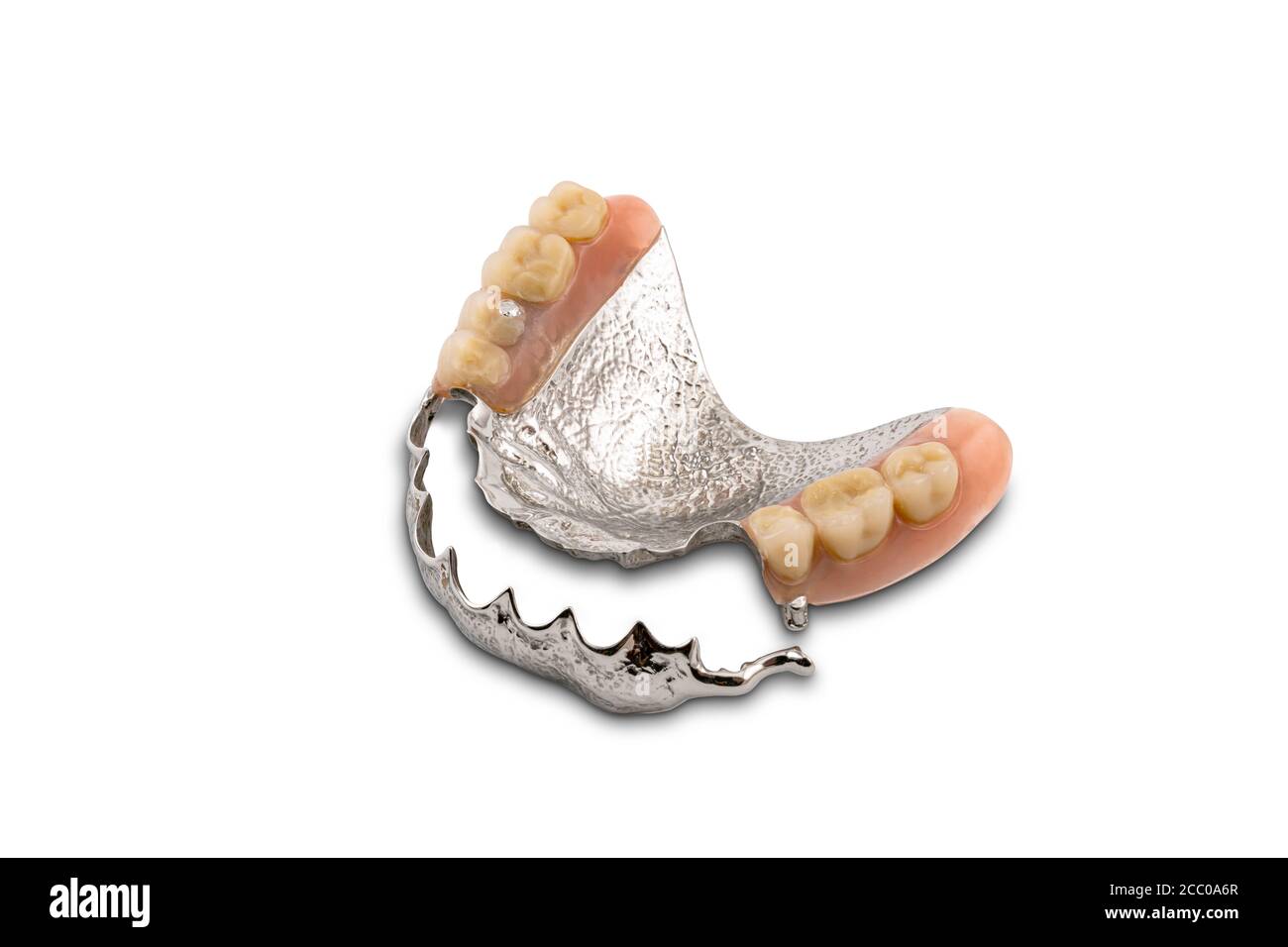Herausnehmbare teilprothese -Fotos und -Bildmaterial in hoher Auflösung ...
