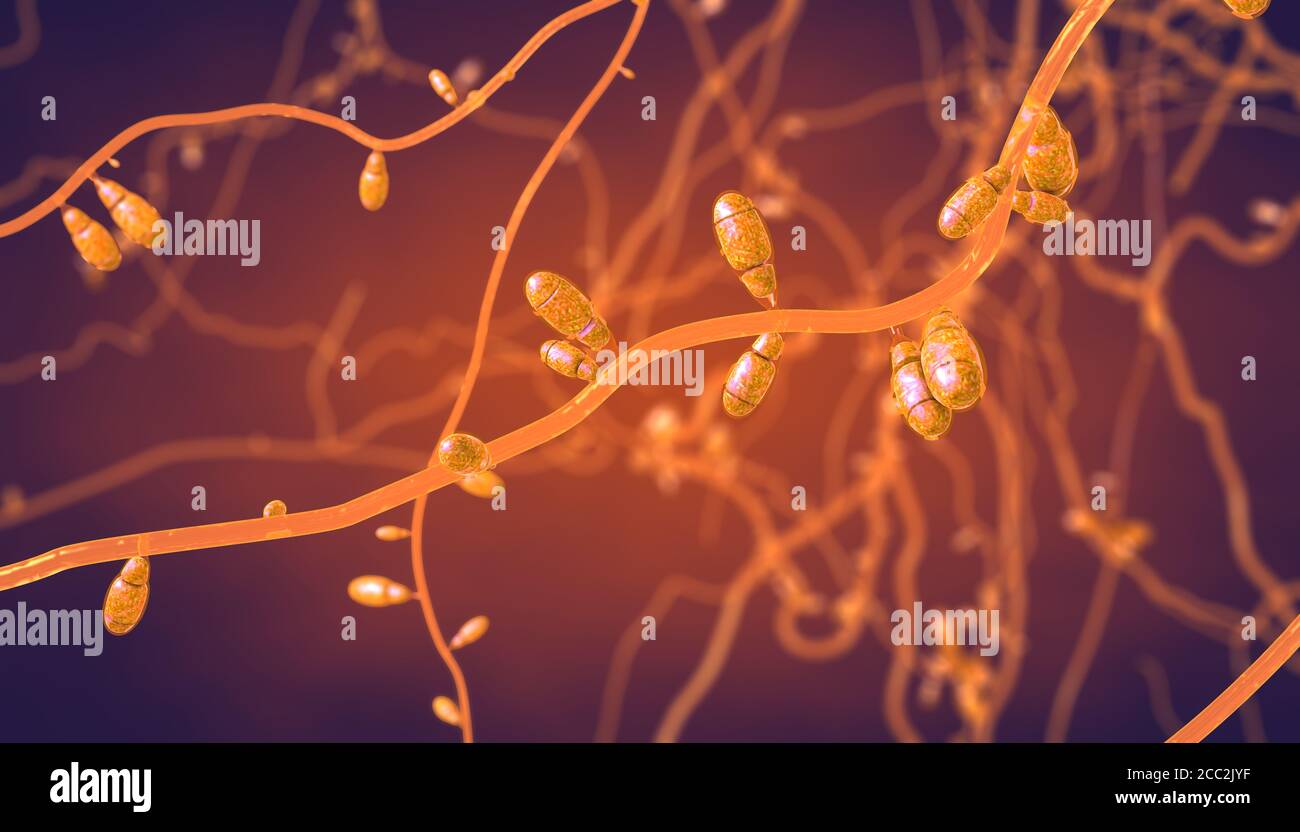 Hautinfektion mit dermatophyten Stockfotos und -bilder Kaufen - Alamy