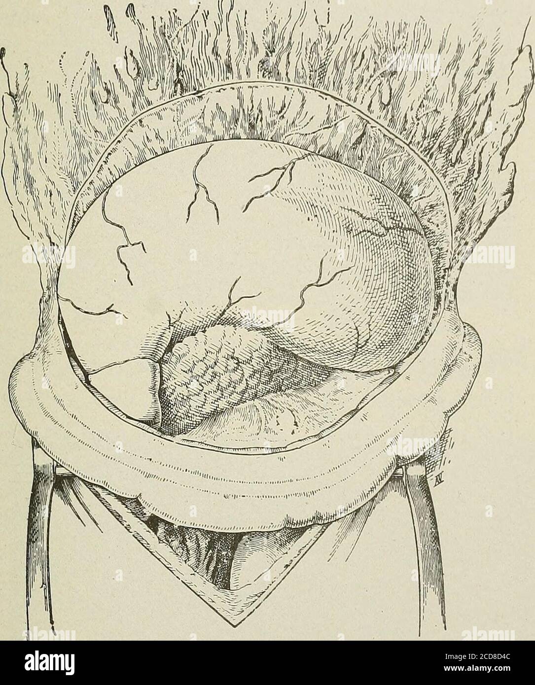 . Medizinische und chirurgische Therapie . Abb. G. – Zugangslinie ...
