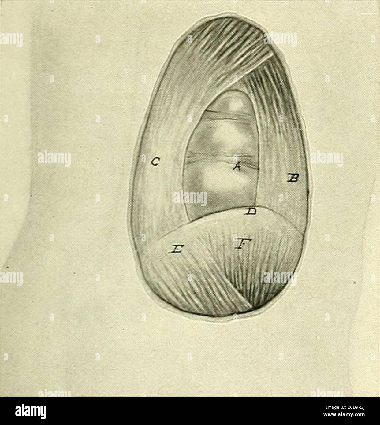 . Chirurgie, ihre Prinzipien und Praxis . in das Rektum. Autopsie ...