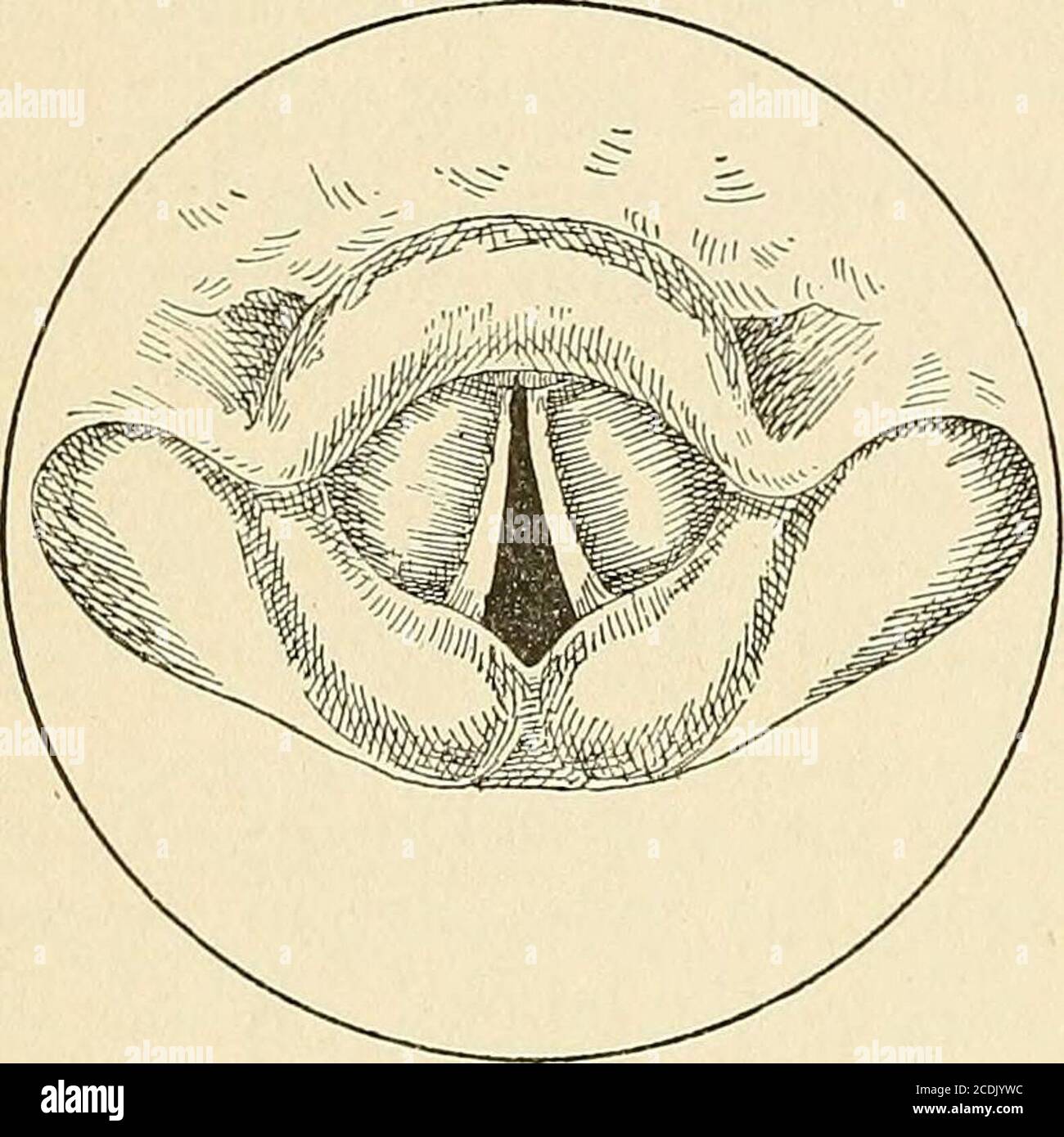 Phlegmone finger -Fotos und -Bildmaterial in hoher Auflösung – Alamy