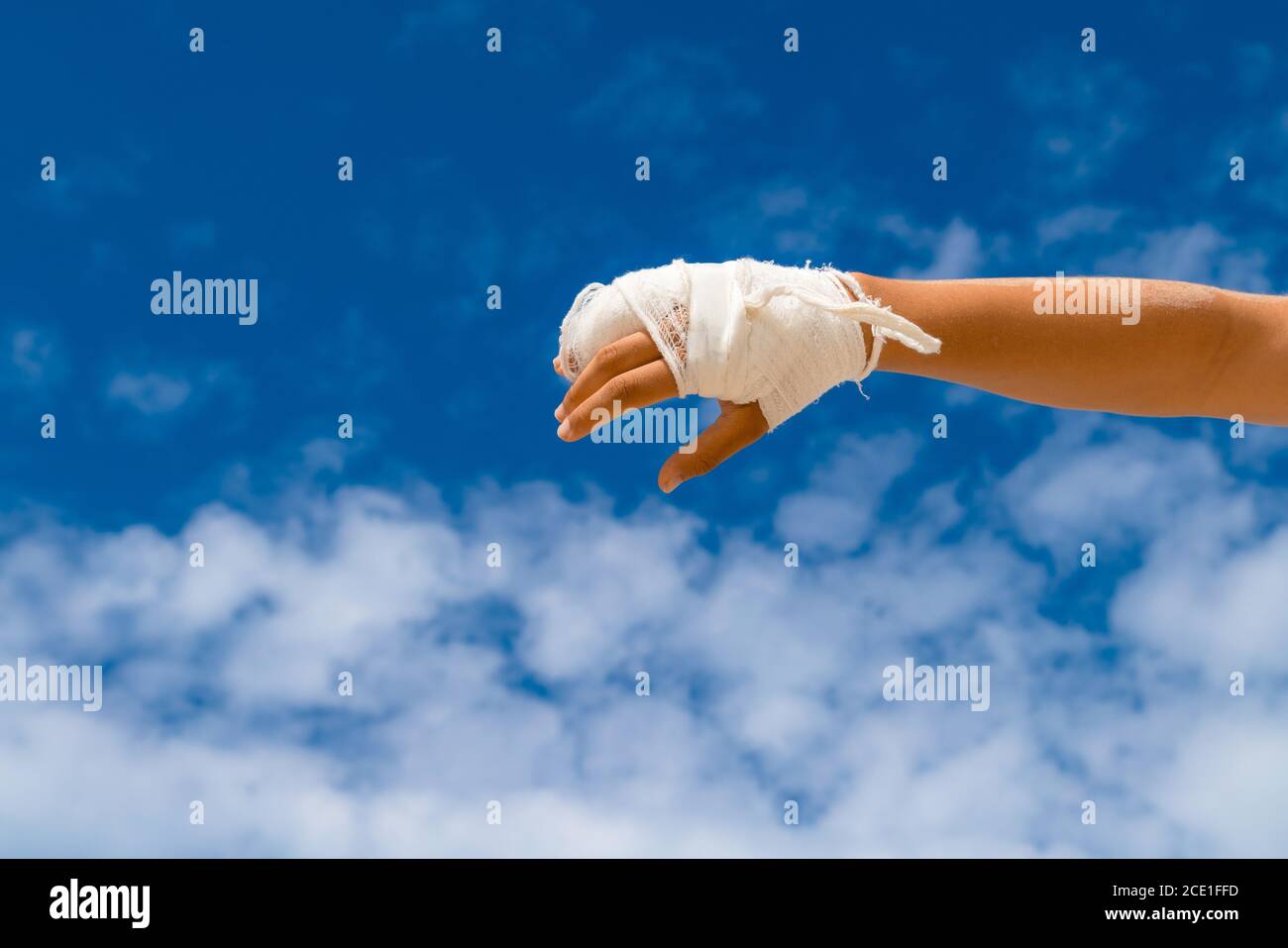 Broken hand -Fotos und -Bildmaterial in hoher Auflösung – Alamy
