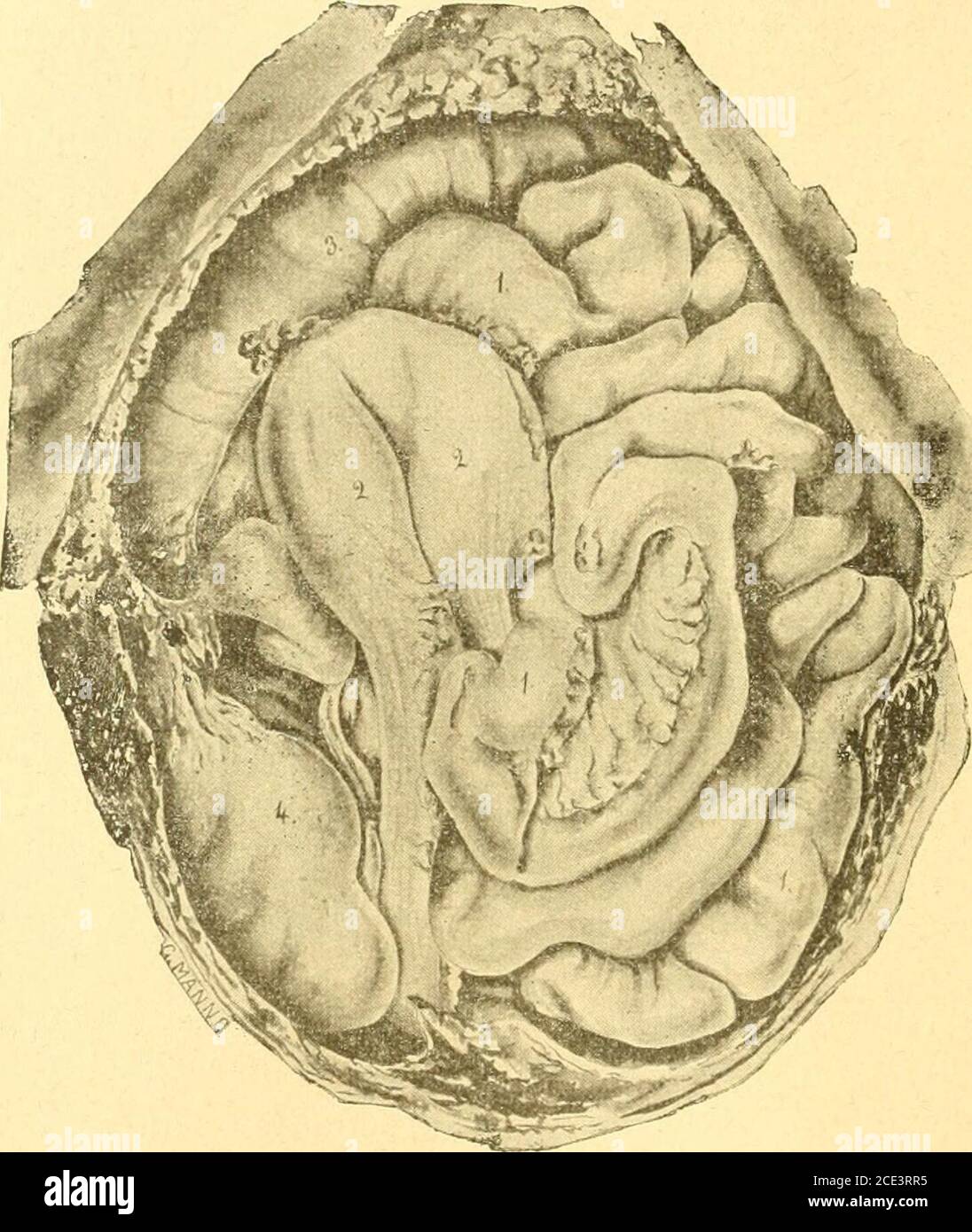 Colon pelvico -Fotos und -Bildmaterial in hoher Auflösung – Alamy