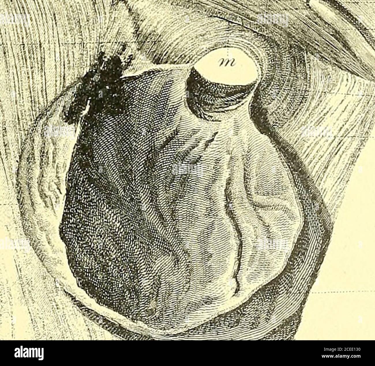 . Die Anatomie und chirurgische Behandlung von Hernien. Platte XLI A ...