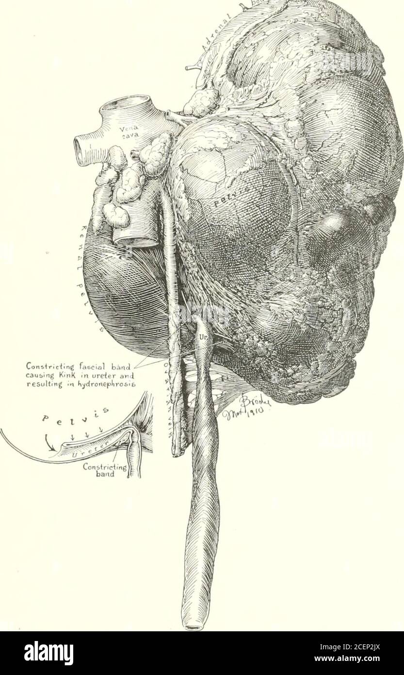 Spezielle Nieren Stockfotos und -bilder Kaufen - Alamy