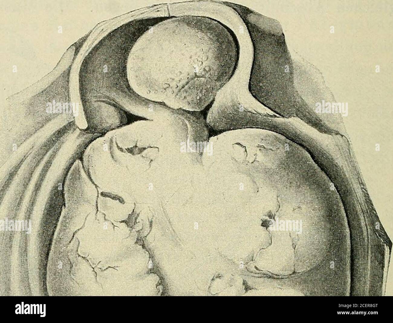 . Lehrbuch der speziellen pathologischen Anatomie für Studierende und ...