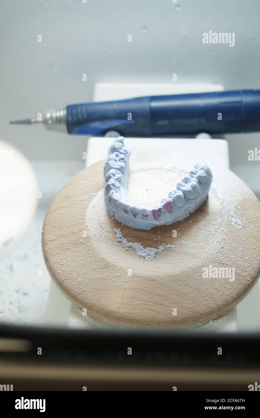 Zahnarzt schleifen von zahnersatz -Fotos und -Bildmaterial in hoher ...