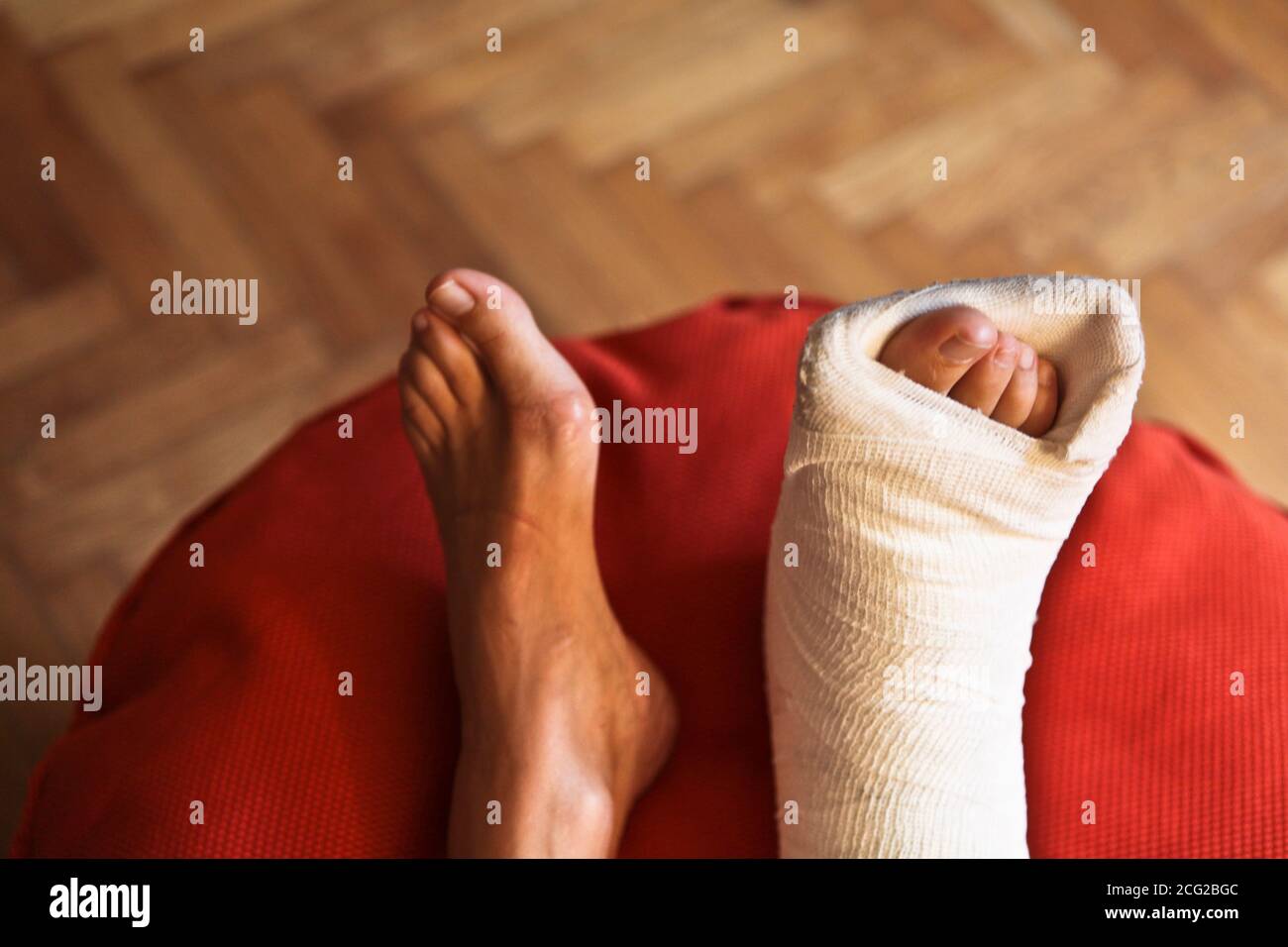 Gipsbeine frauen -Fotos und -Bildmaterial in hoher Auflösung – Alamy