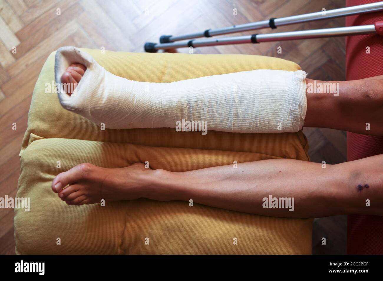 Gips liege medizin -Fotos und -Bildmaterial in hoher Auflösung - Seite ...