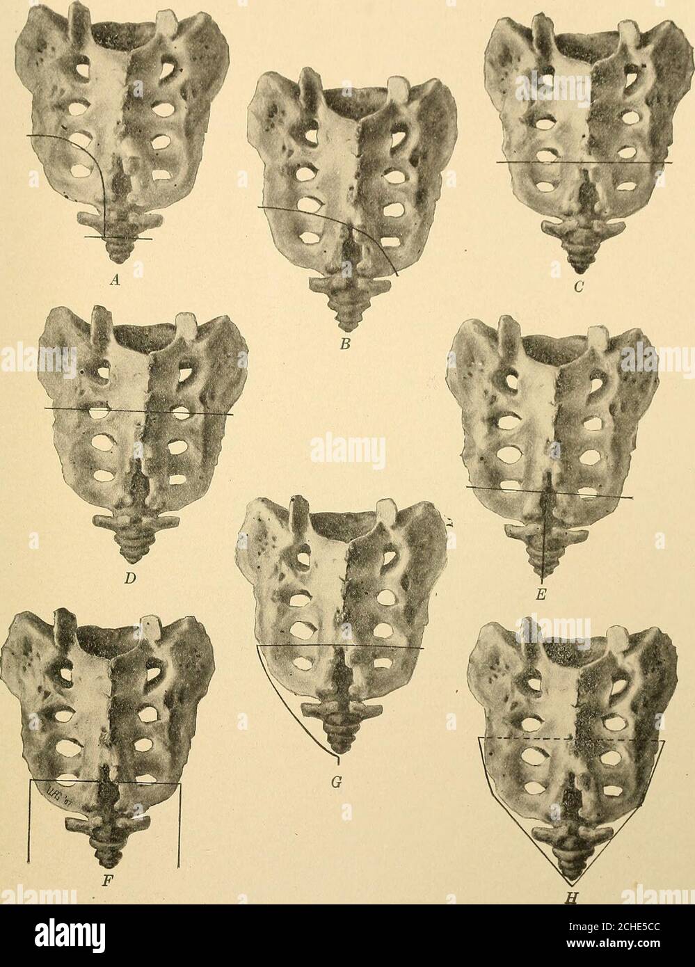 Lithotomy position -Fotos und -Bildmaterial in hoher Auflösung – Alamy