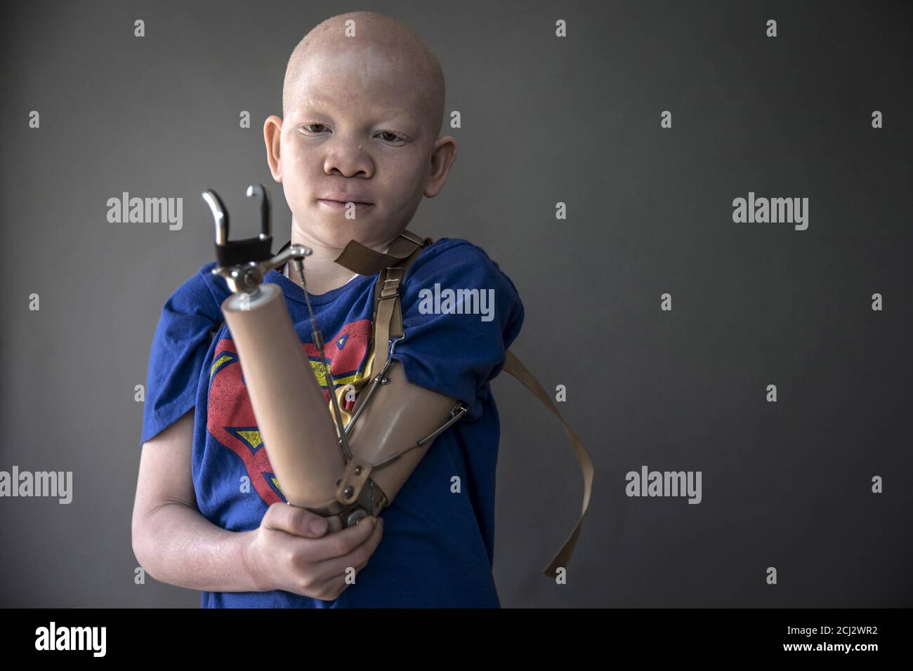 Albino body parts -Fotos und -Bildmaterial in hoher Auflösung – Alamy