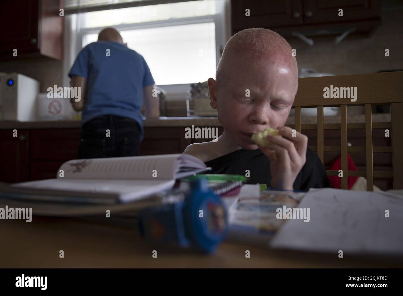 Albino body parts -Fotos und -Bildmaterial in hoher Auflösung – Alamy