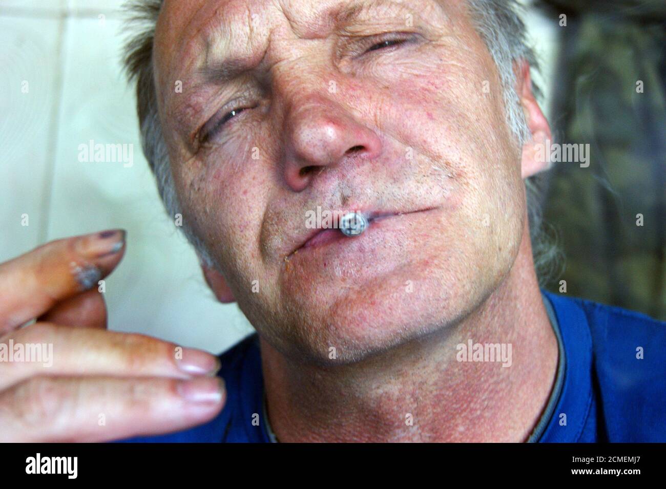 Ungesunde person -Fotos und -Bildmaterial in hoher Auflösung – Alamy