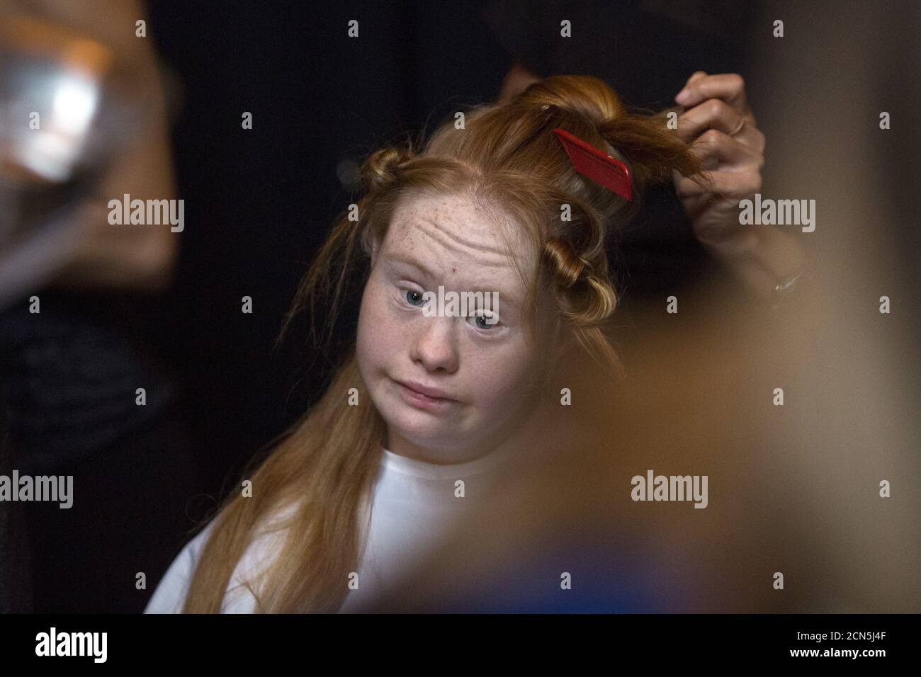 Modell mit down syndrom -Fotos und -Bildmaterial in hoher Auflösung – Alamy