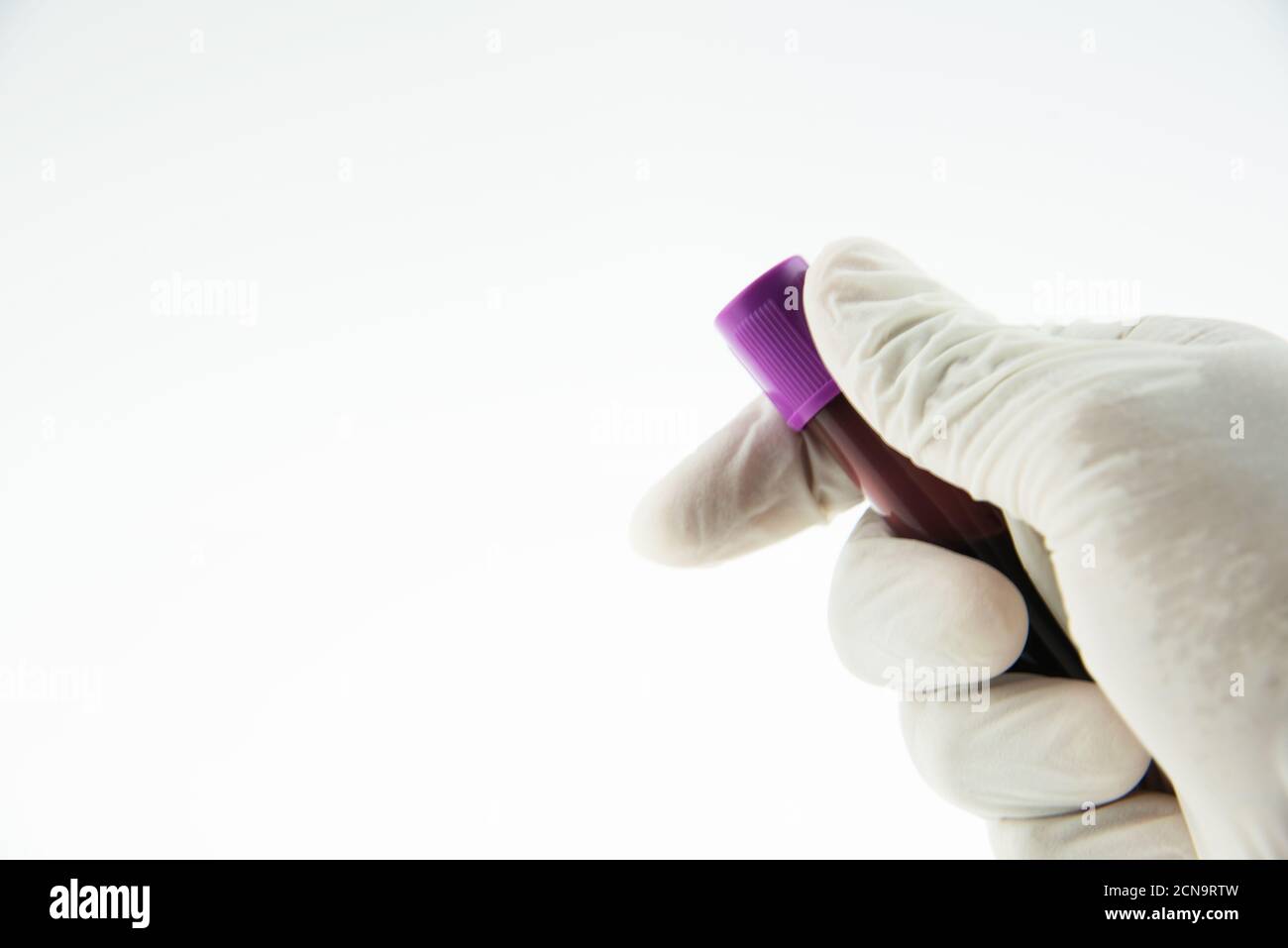 Vacutainer EDTA Blutentnahme-Röhrchen Stockfotografie - Alamy