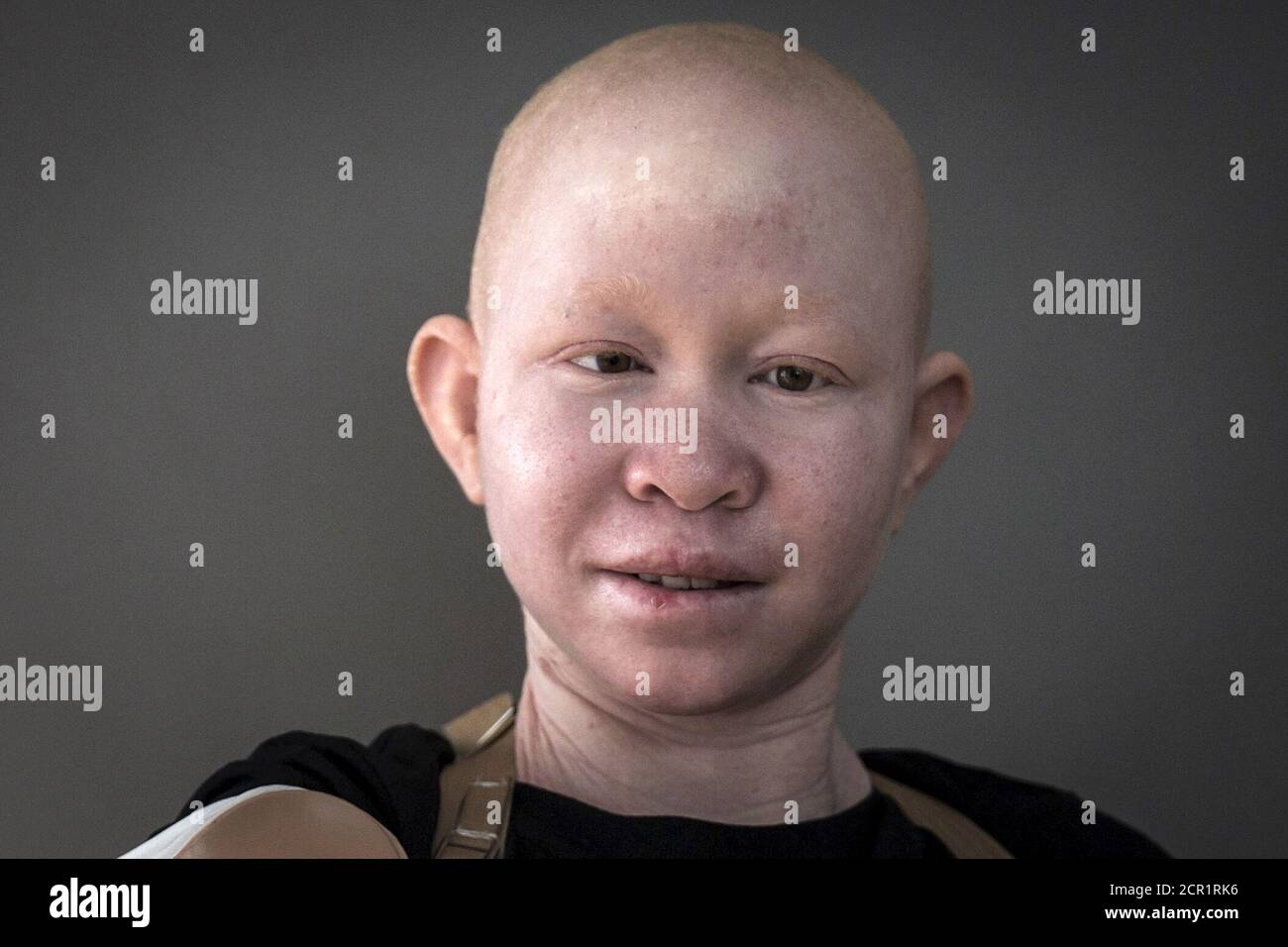 Albino body parts -Fotos und -Bildmaterial in hoher Auflösung – Alamy