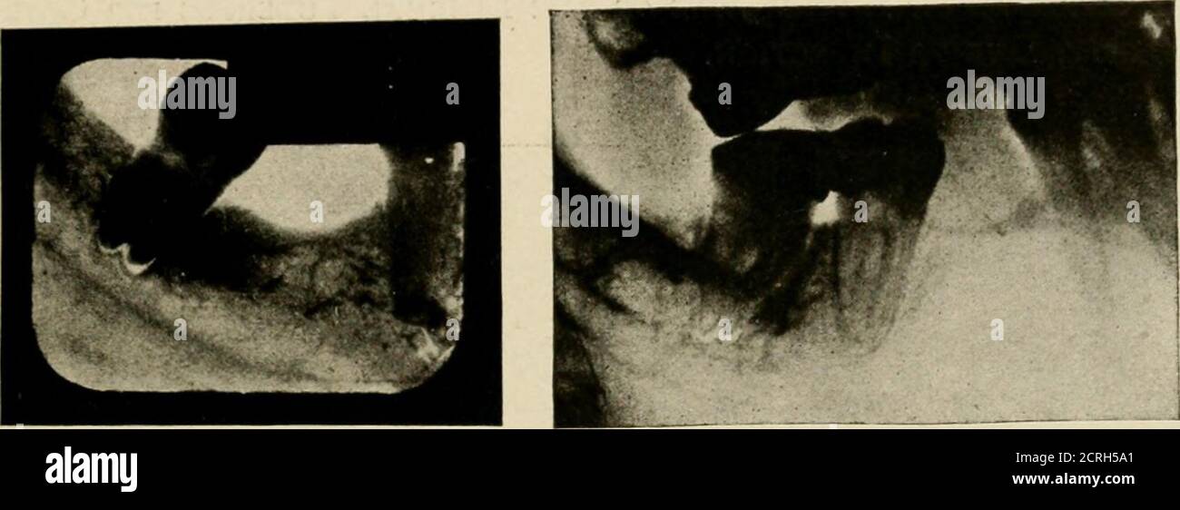 . Elementare und dentale Radiographie / von Howard Riley Raper ...