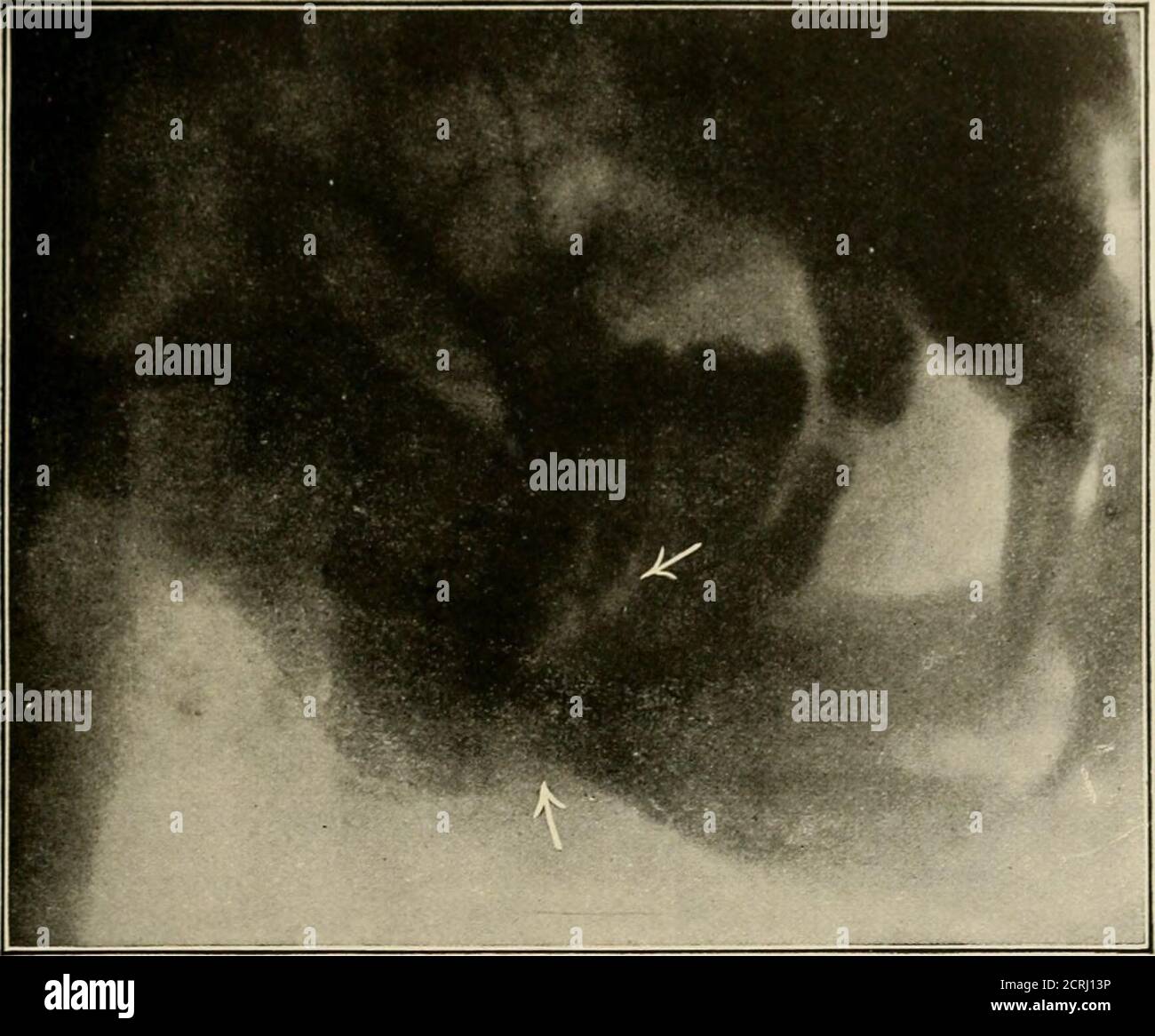 . Elementare und dentale Radiographie / von Howard Riley Raper . 9. Die ...