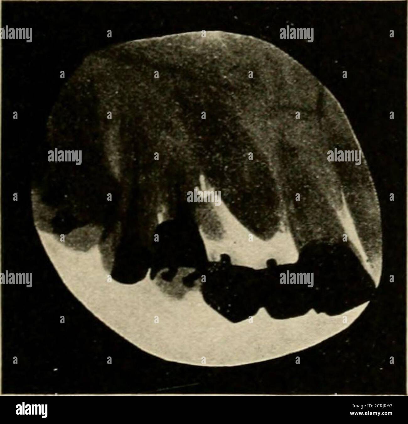 . Elementare und dentale Radiographie / von Howard Riley Raper . Abb ...