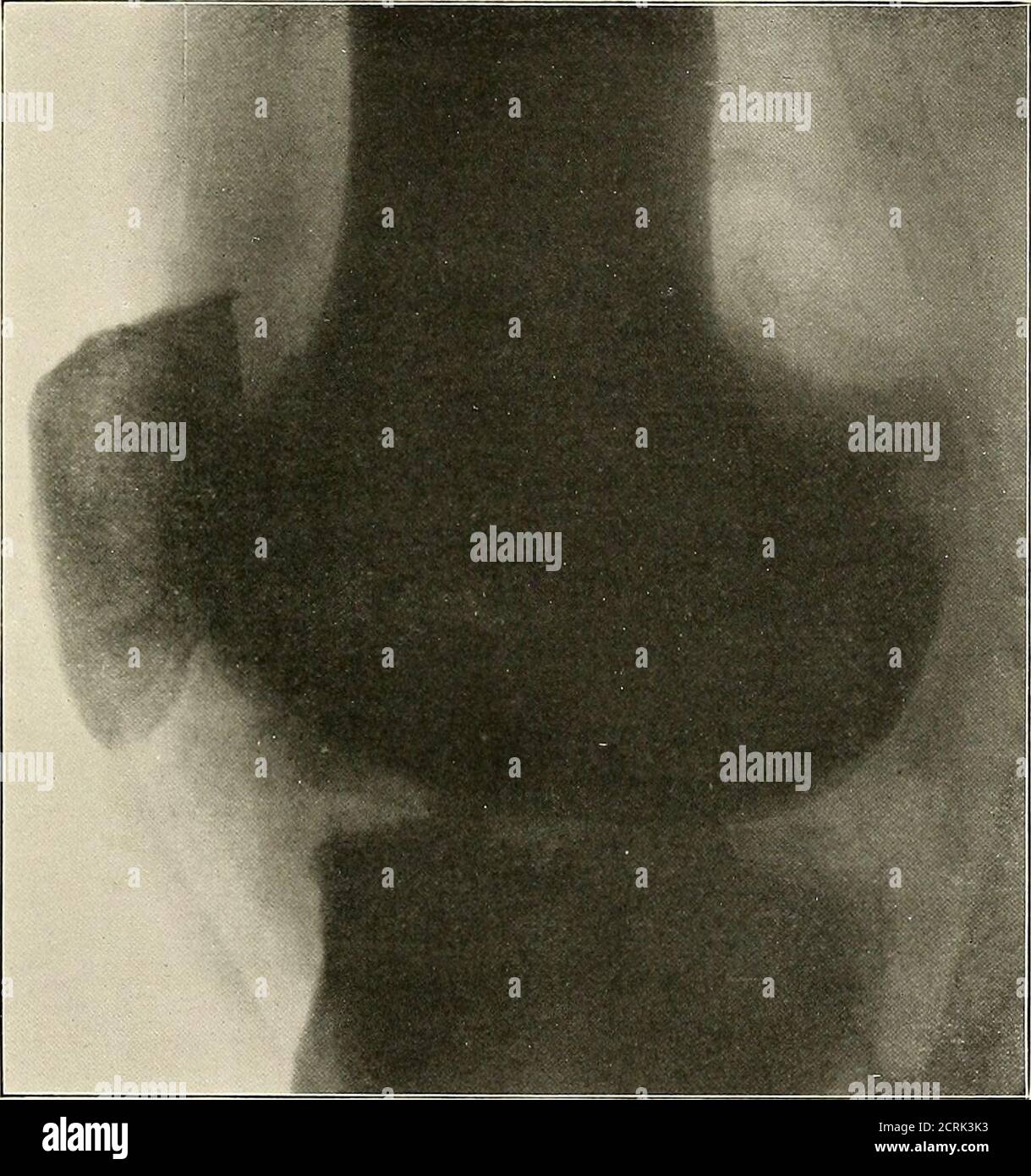 . Ein radiographischer Atlas der pathologischen Veränderungen von ...