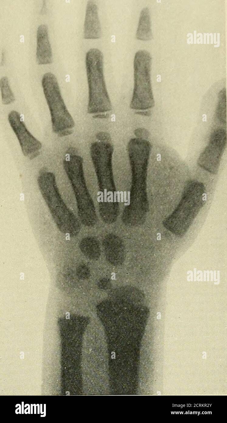 Abb 4 zeigt die hand -Fotos und -Bildmaterial in hoher Auflösung – Alamy