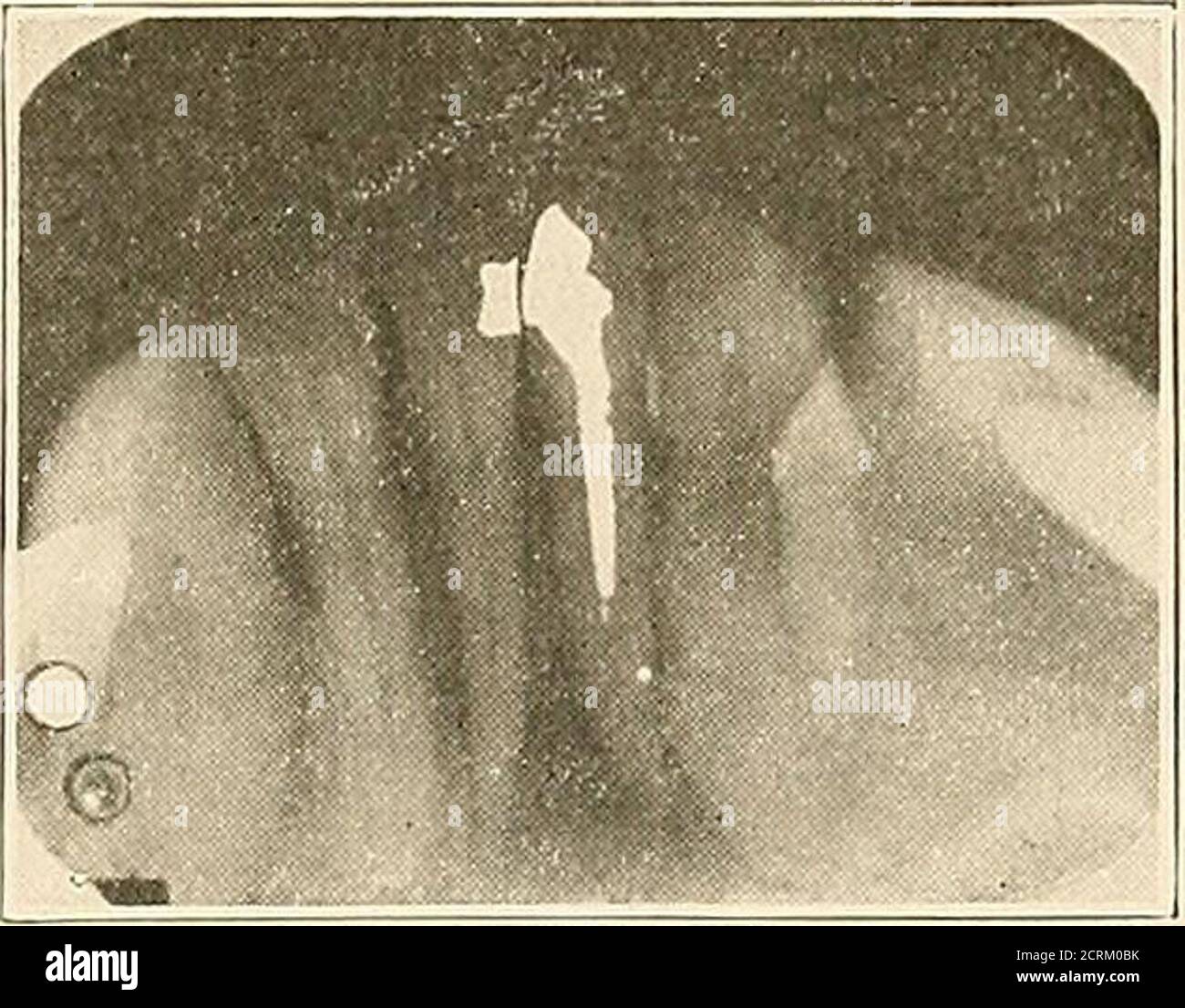 . Interpretation von dentalen & kieferförmigen Roentgenogrammen . Abb ...