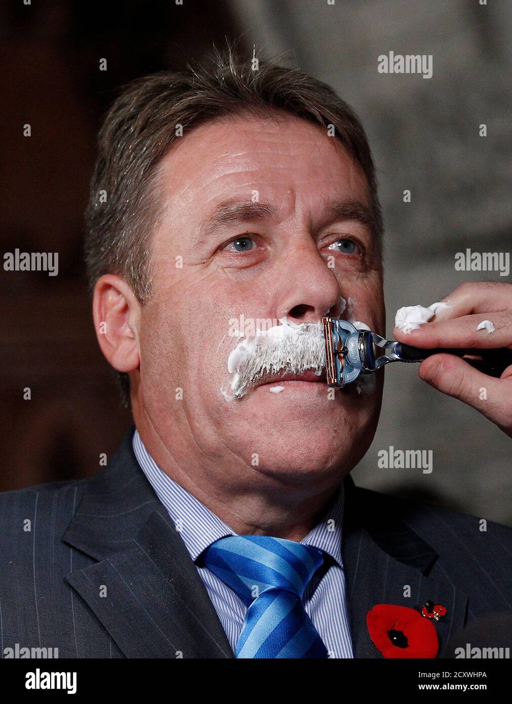 Menschlicher prostatakrebs -Fotos und -Bildmaterial in hoher Auflösung ...