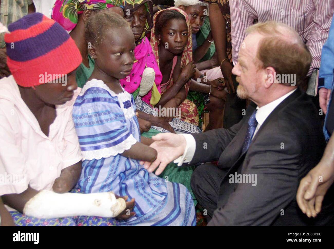 Beide arm amputiert -Fotos und -Bildmaterial in hoher Auflösung – Alamy