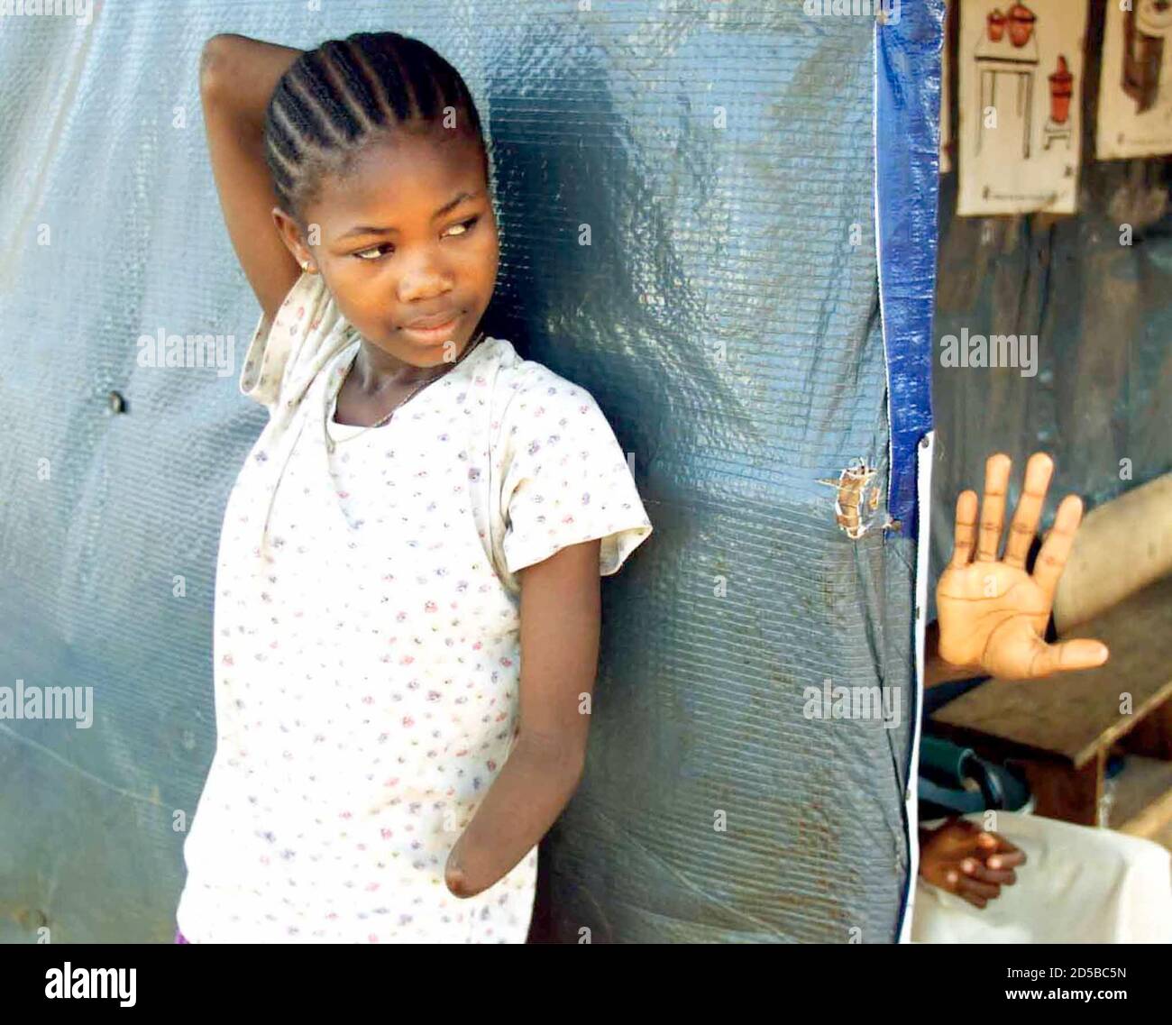 Hände amputiert -Fotos und -Bildmaterial in hoher Auflösung – Alamy