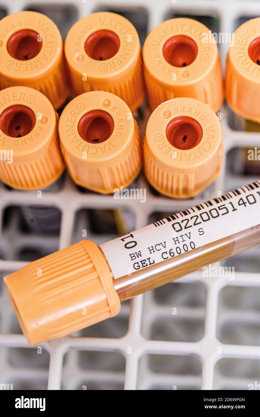 Serologie der syphilis -Fotos und -Bildmaterial in hoher Auflösung – Alamy