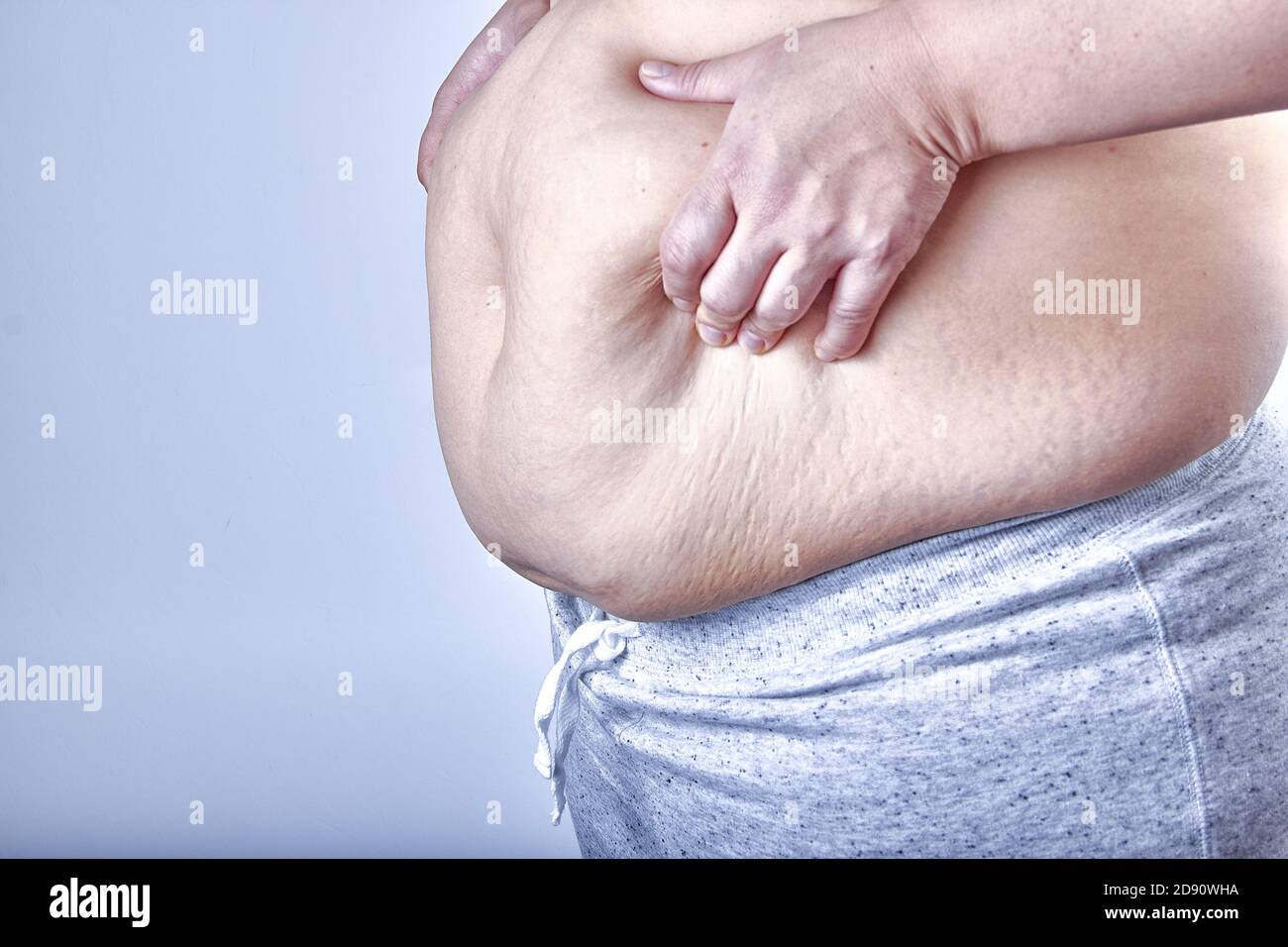 Fettleibig frau bauch -Fotos und -Bildmaterial in hoher Auflösung – Alamy