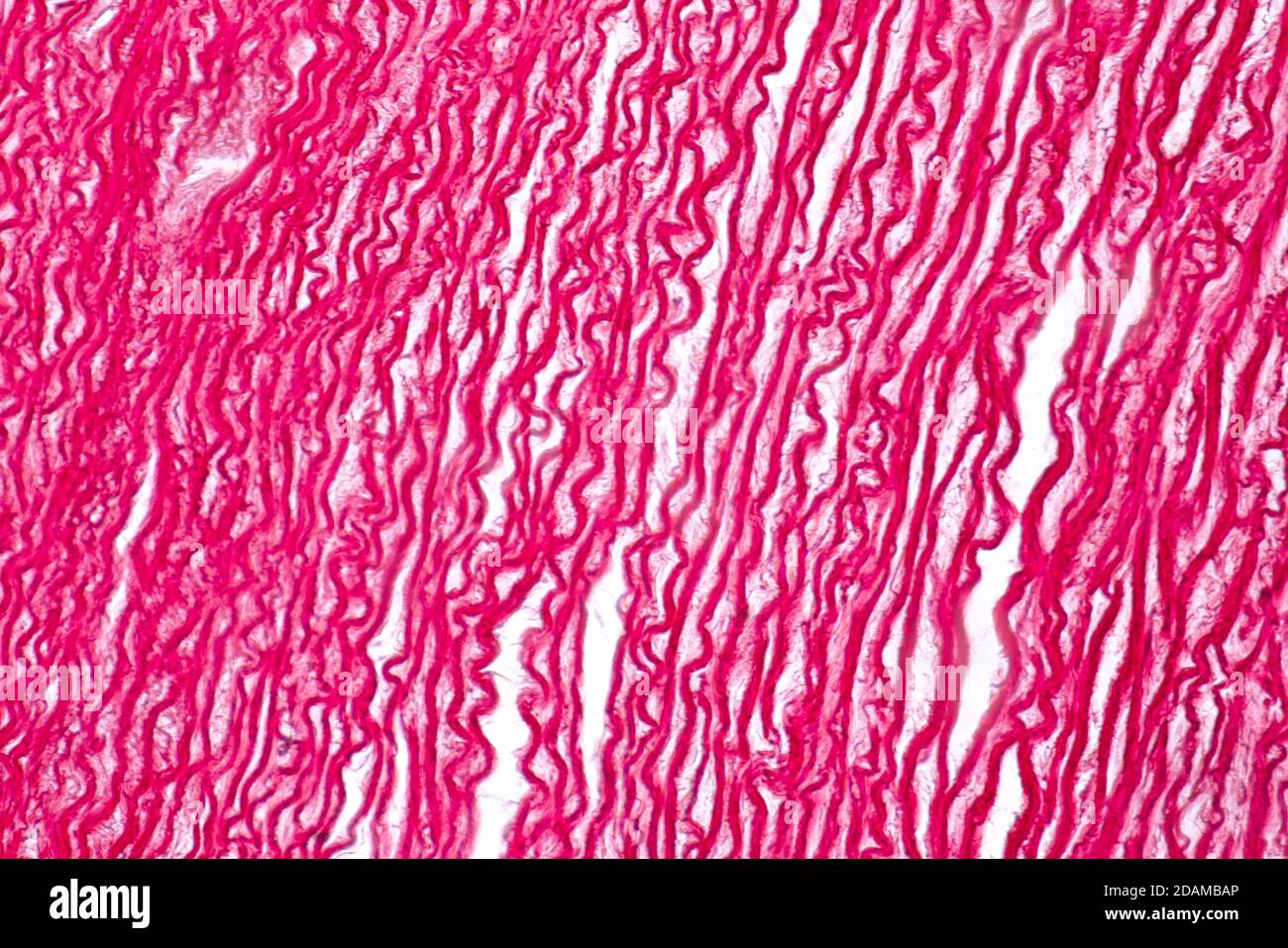 Gewebe der sehne -Fotos und -Bildmaterial in hoher Auflösung – Alamy