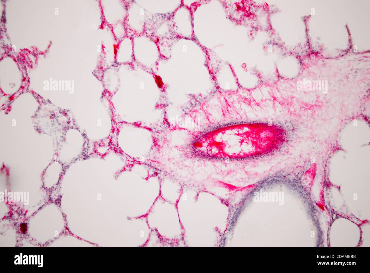 Menschliche lungen anatomie und histologie -Fotos und -Bildmaterial in ...
