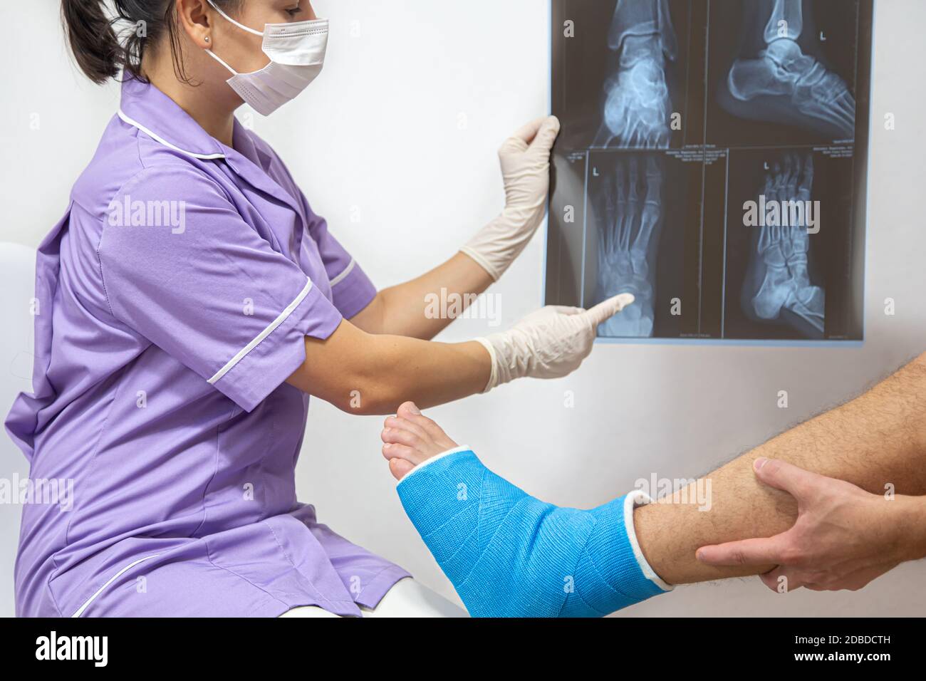 Luxation finger röntgen verrenkung -Fotos und -Bildmaterial in hoher ...