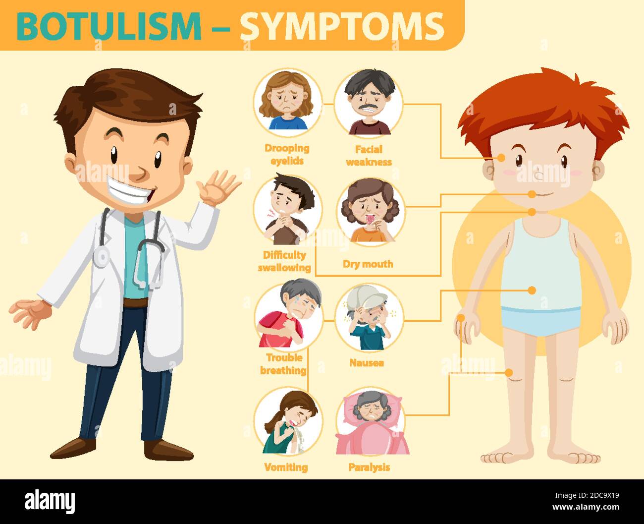 Botulismus Symptome Informationen Infografik Illustration Stock ...