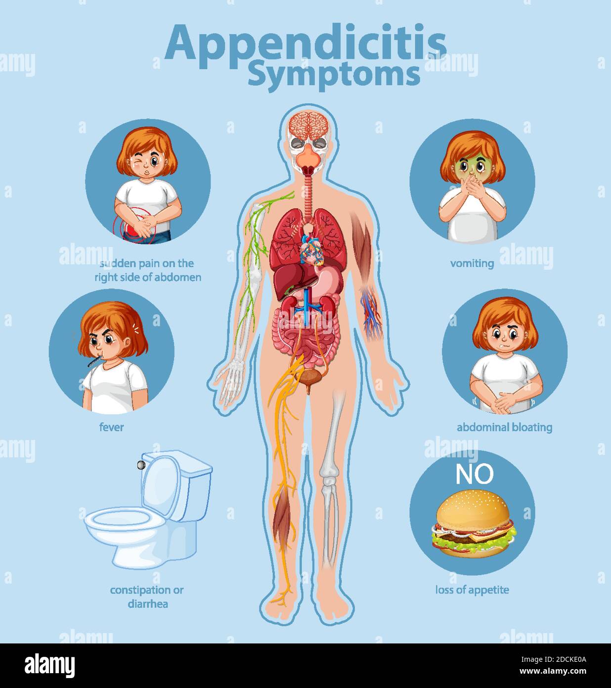 Infografik zur Beschreibung der Symptome von Appendizitis Stock ...