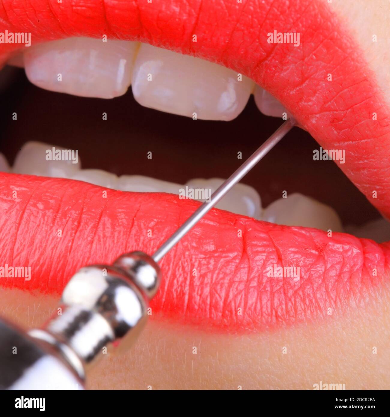 Medical teeth -Fotos und -Bildmaterial in hoher Auflösung – Alamy