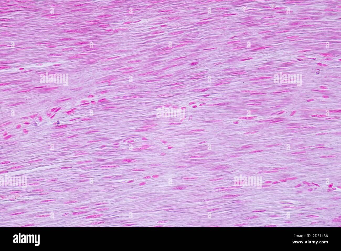 Glatte muskelfaser -Fotos und -Bildmaterial in hoher Auflösung – Alamy