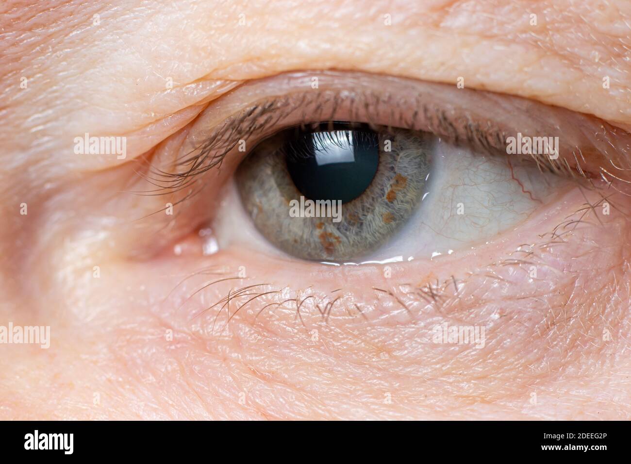 Augenlider weggelassen -Fotos und -Bildmaterial in hoher Auflösung – Alamy