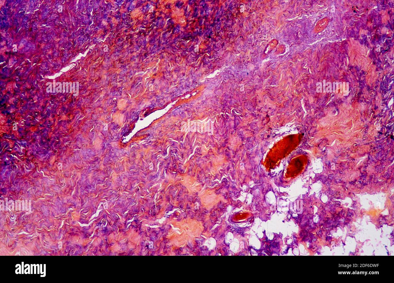 Faseriges Knorpelgewebe oder Fibroknorpel mit Kollagenfasern. Optisches ...