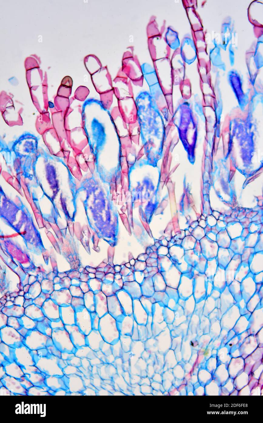 Moss microscope -Fotos und -Bildmaterial in hoher Auflösung – Alamy