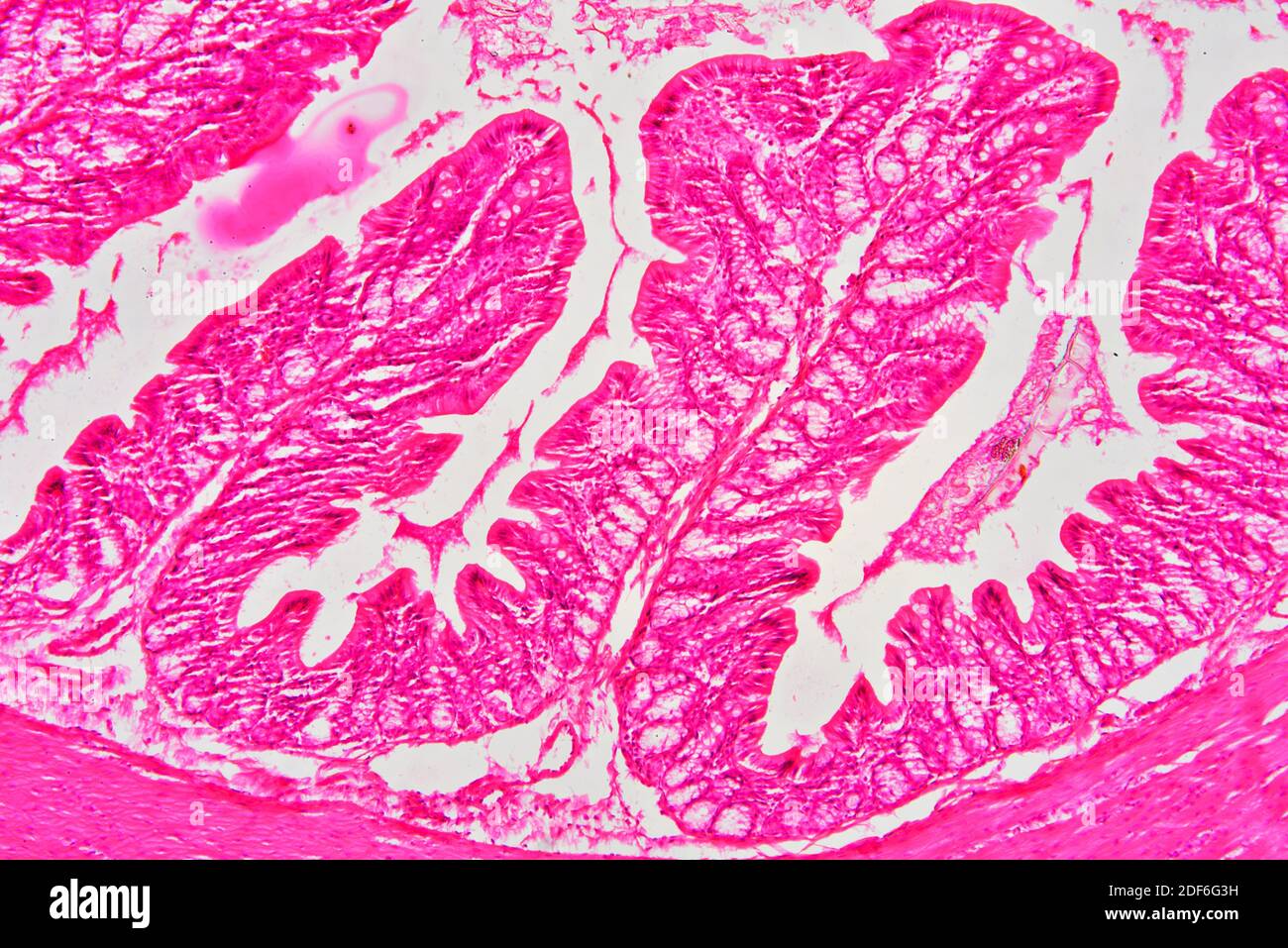 Intestine villi micrograph -Fotos und -Bildmaterial in hoher Auflösung ...
