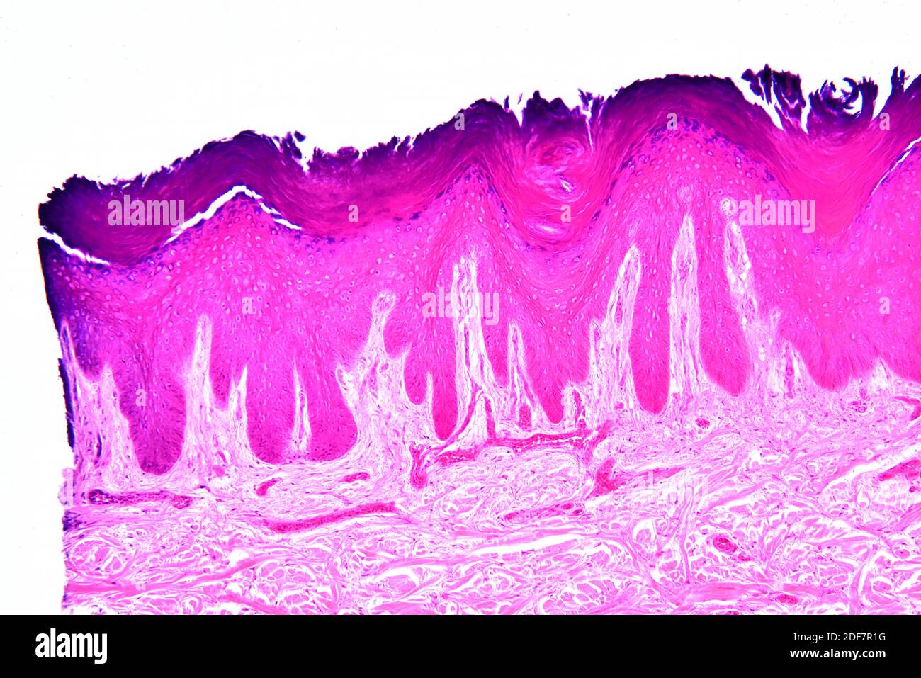 Geschichtetes plattenepithel Stockfotos und -bilder Kaufen - Alamy