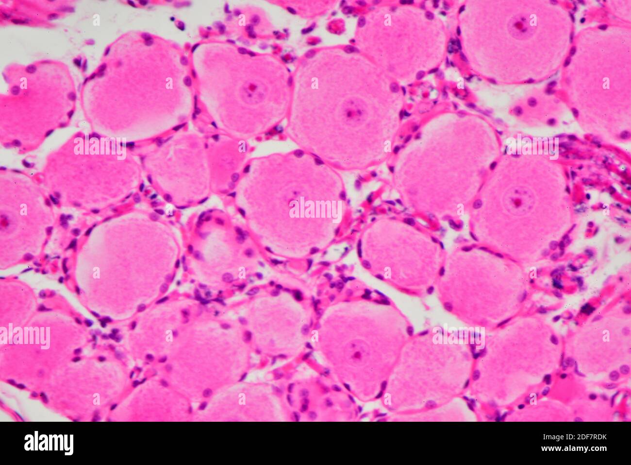 Autonomes ganglion -Fotos und -Bildmaterial in hoher Auflösung – Alamy