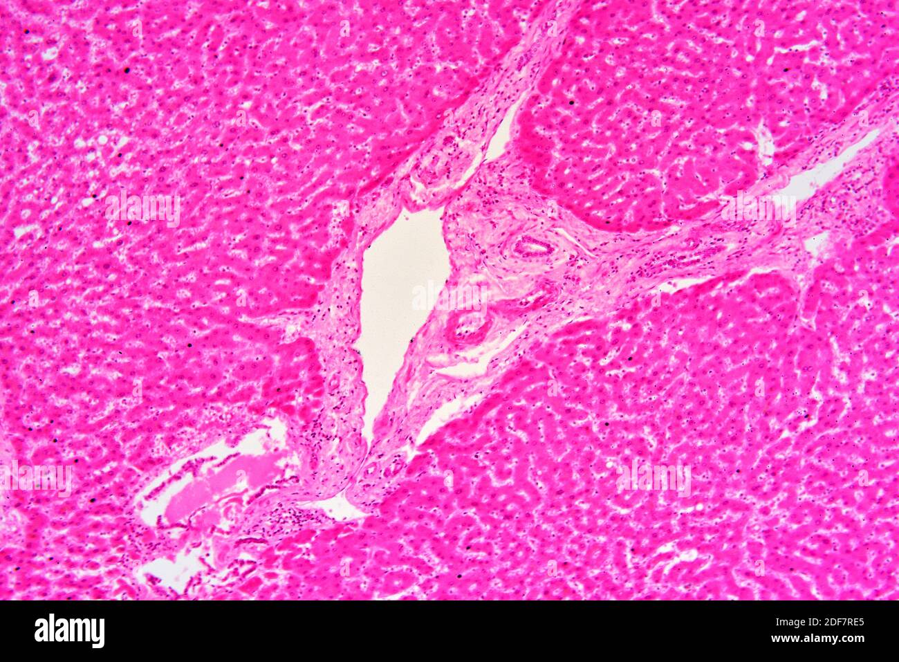 Leber mensch gesund -Fotos und -Bildmaterial in hoher Auflösung – Alamy