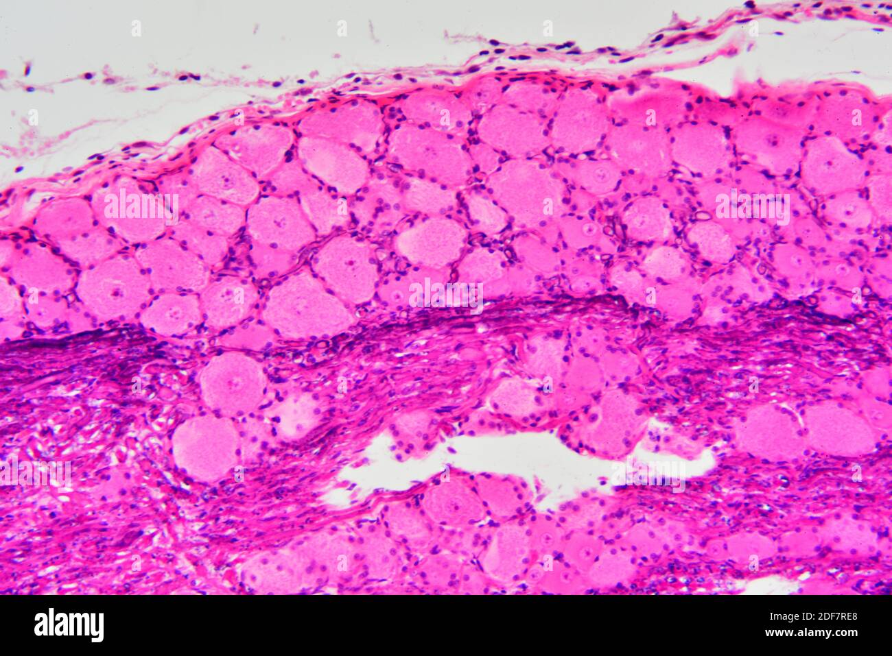 Autonomes ganglion -Fotos und -Bildmaterial in hoher Auflösung – Alamy