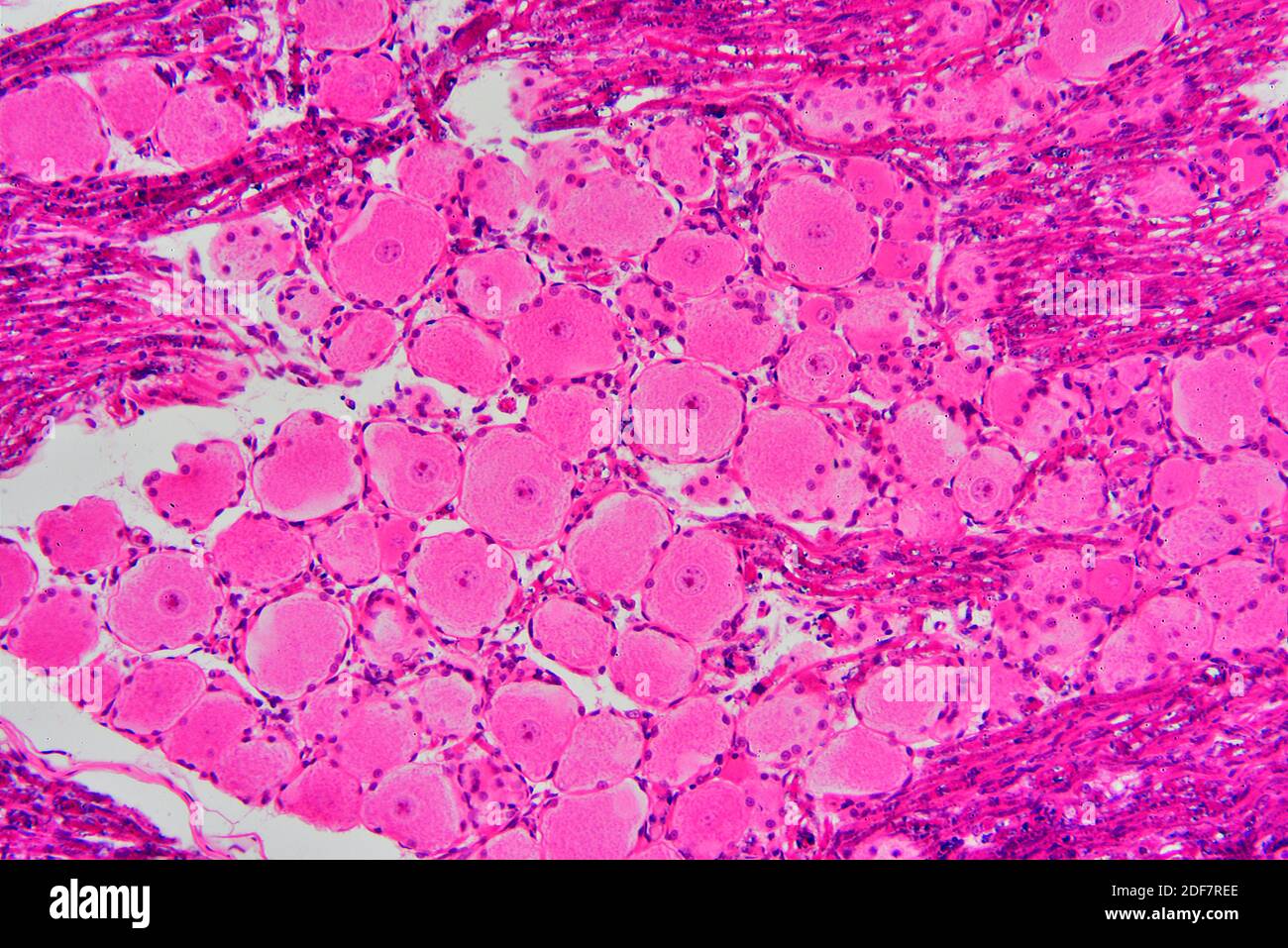 Autonomes ganglion -Fotos und -Bildmaterial in hoher Auflösung – Alamy